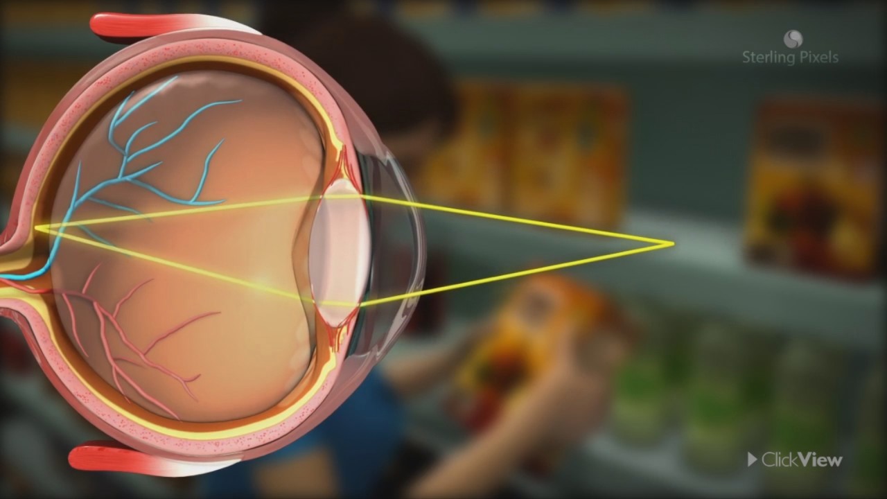 Power of Accommodation of the Human Eye | ClickView