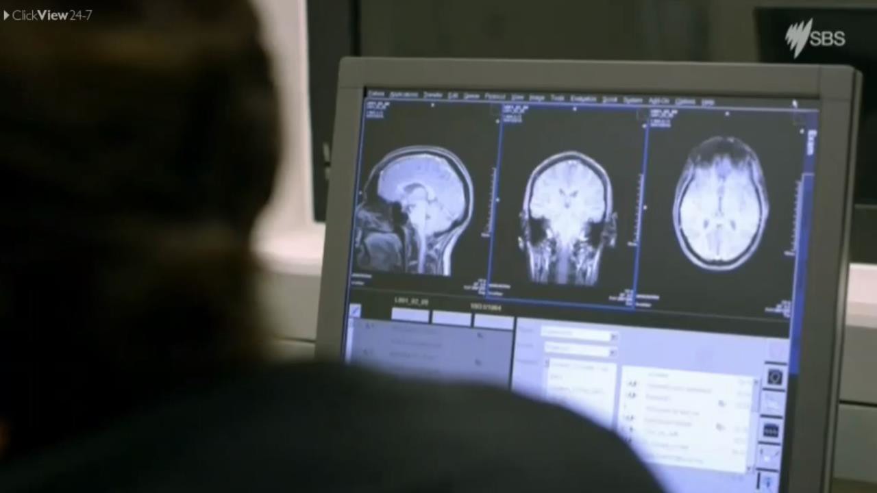 The Brain Videos, Resources & Worksheets | ClickView