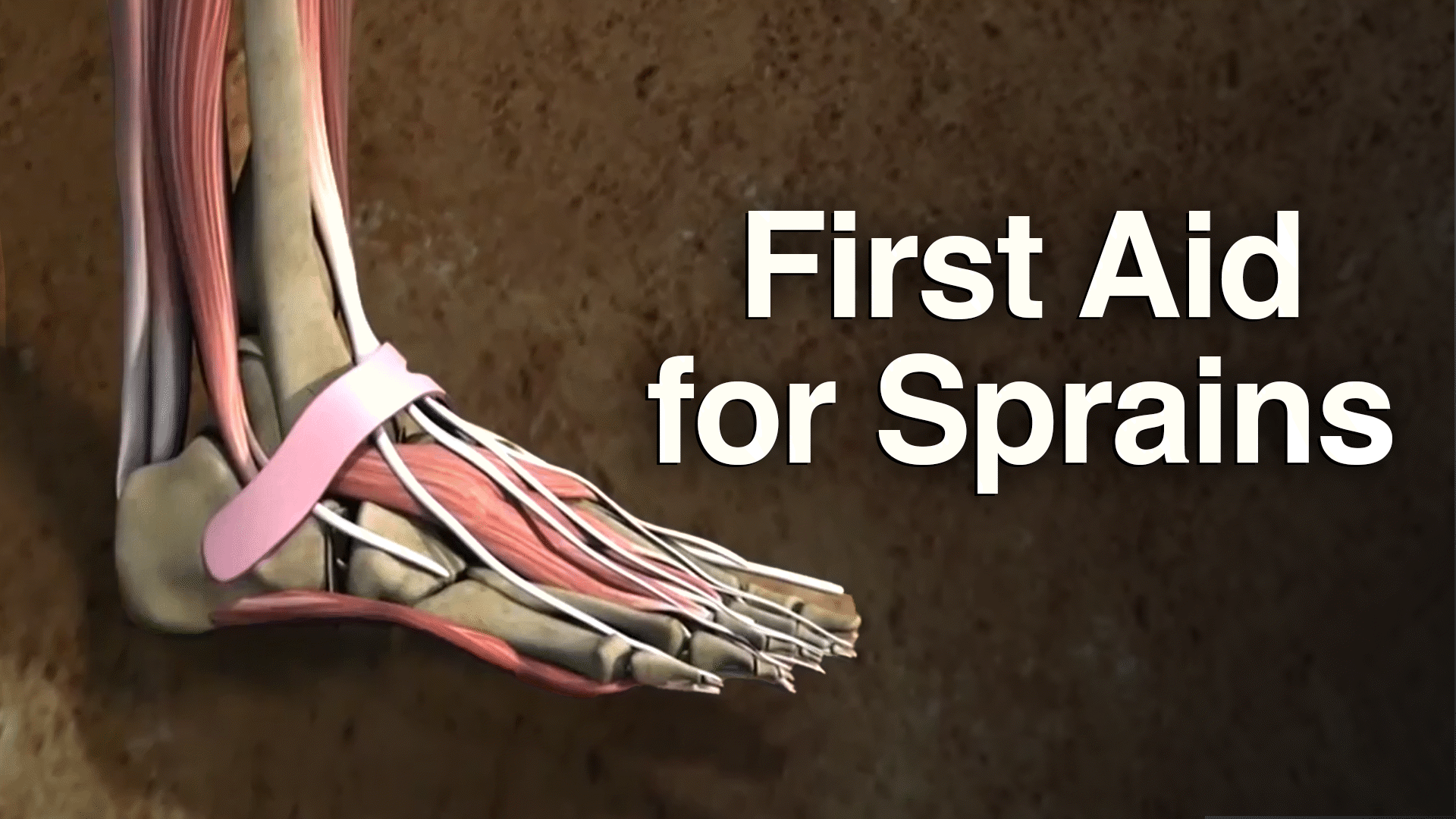 First Aid for Sprains Video & Resources | ClickView