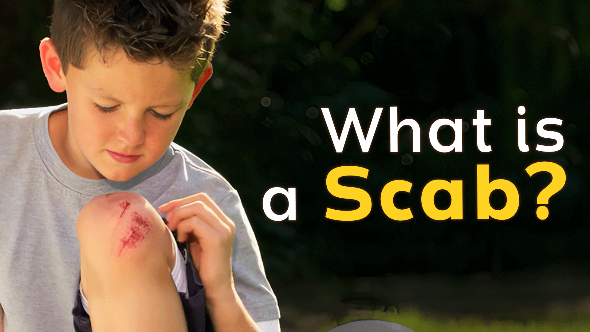 What Is a Scab? Video & Resources | ClickView