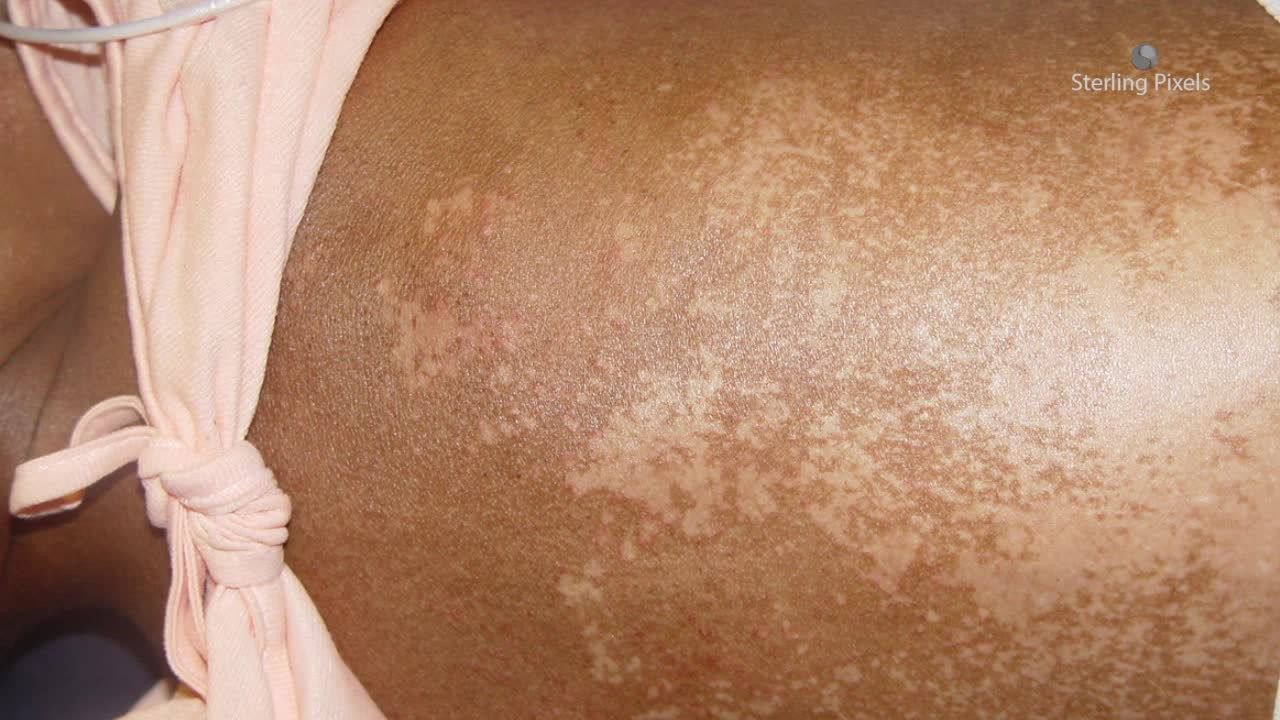 Nutrients and Their Deficiency Diseases | ClickView