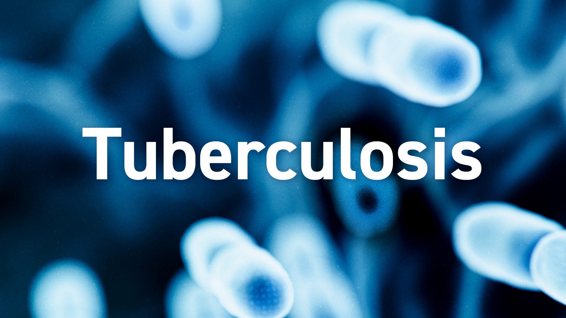 Terrible TB: Part 1 Video & Resources | ClickView